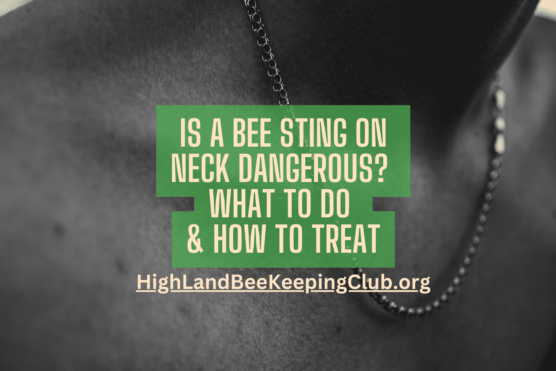 Is A Bee Sting On Neck Dangerous: What To Do And How To Treat