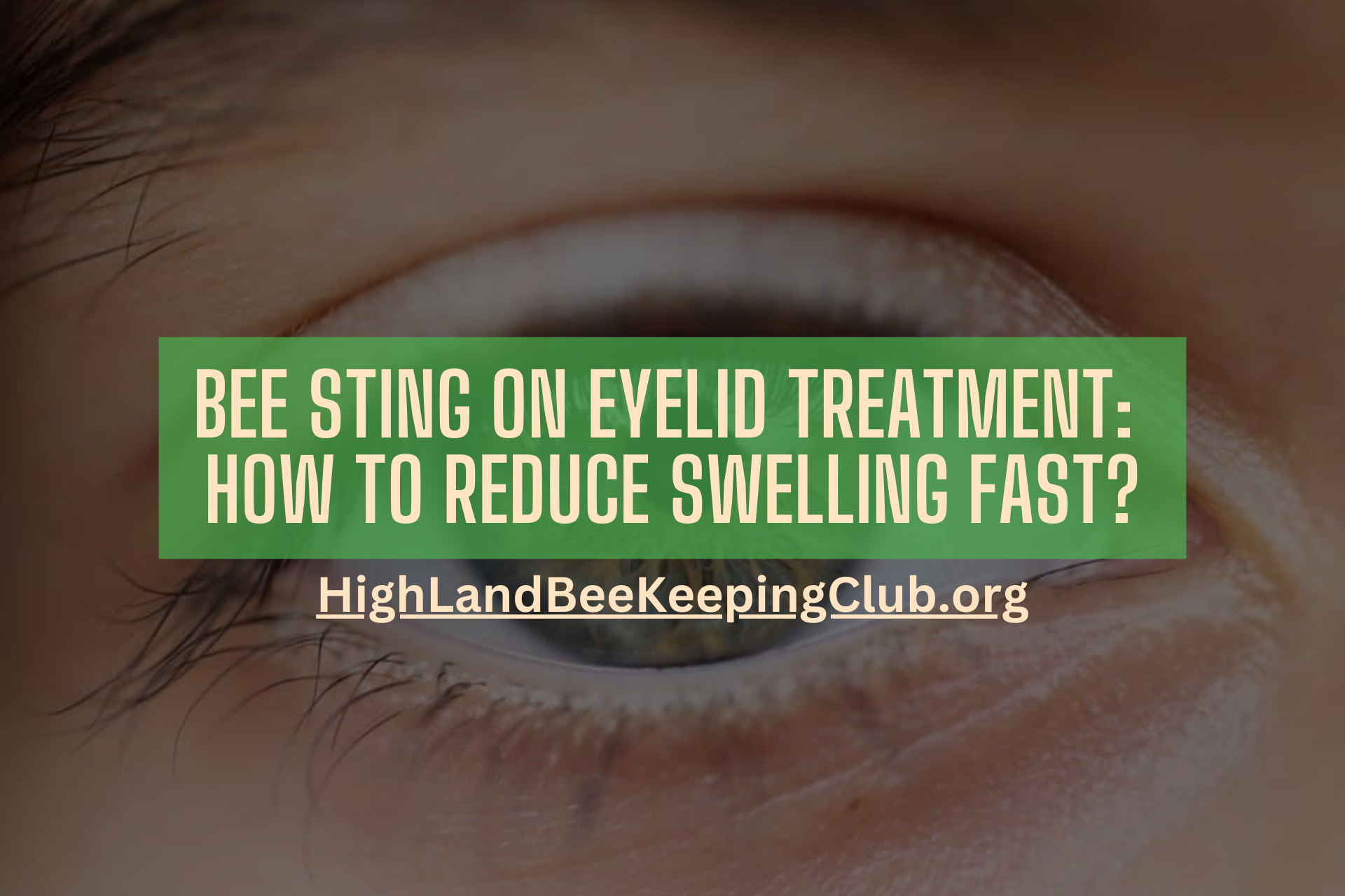 Bee Sting on Eyelid Treatment: How To Reduce Swelling Fast?