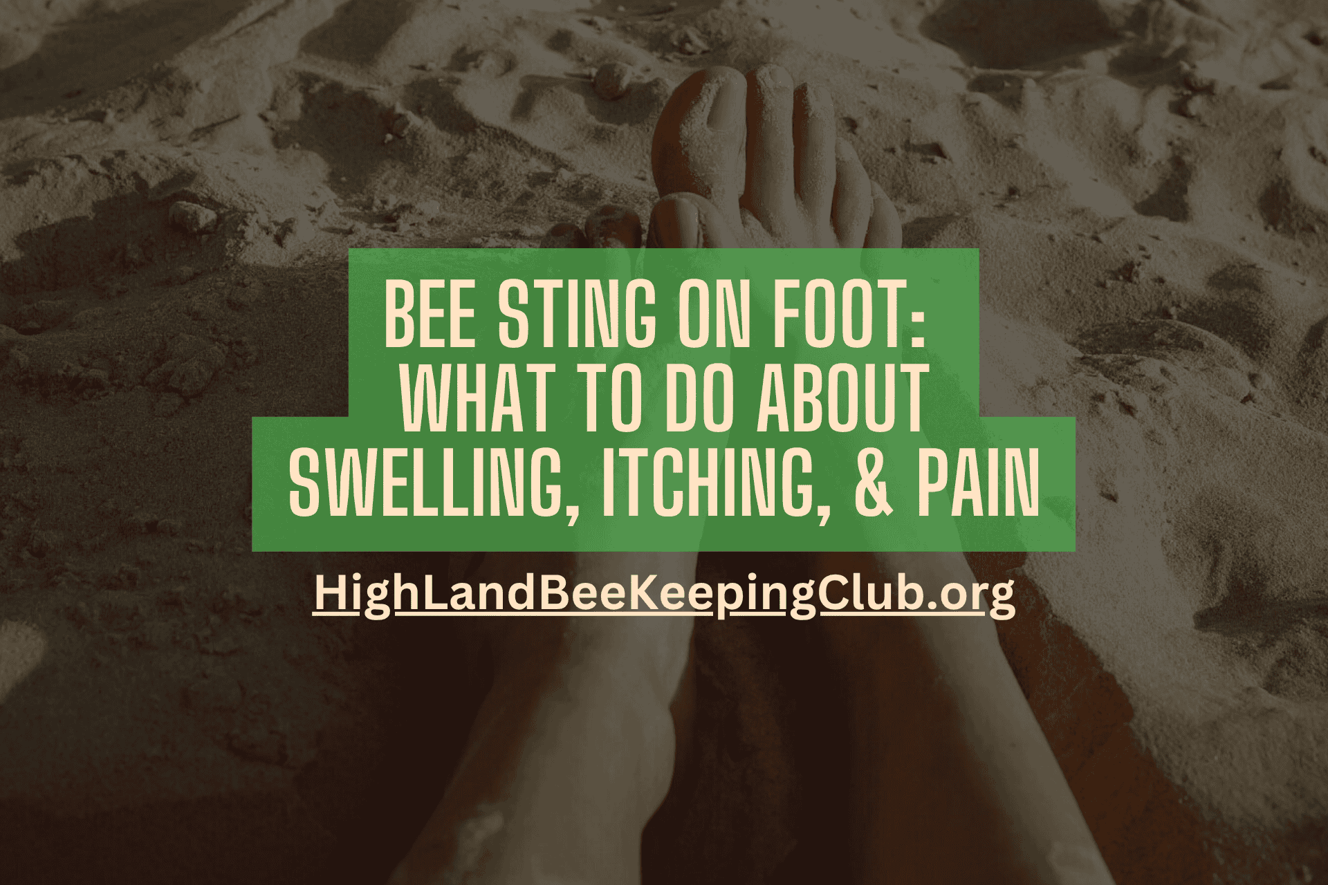 Bee Sting on Foot: What to Do About Swelling, Itching, & Pain