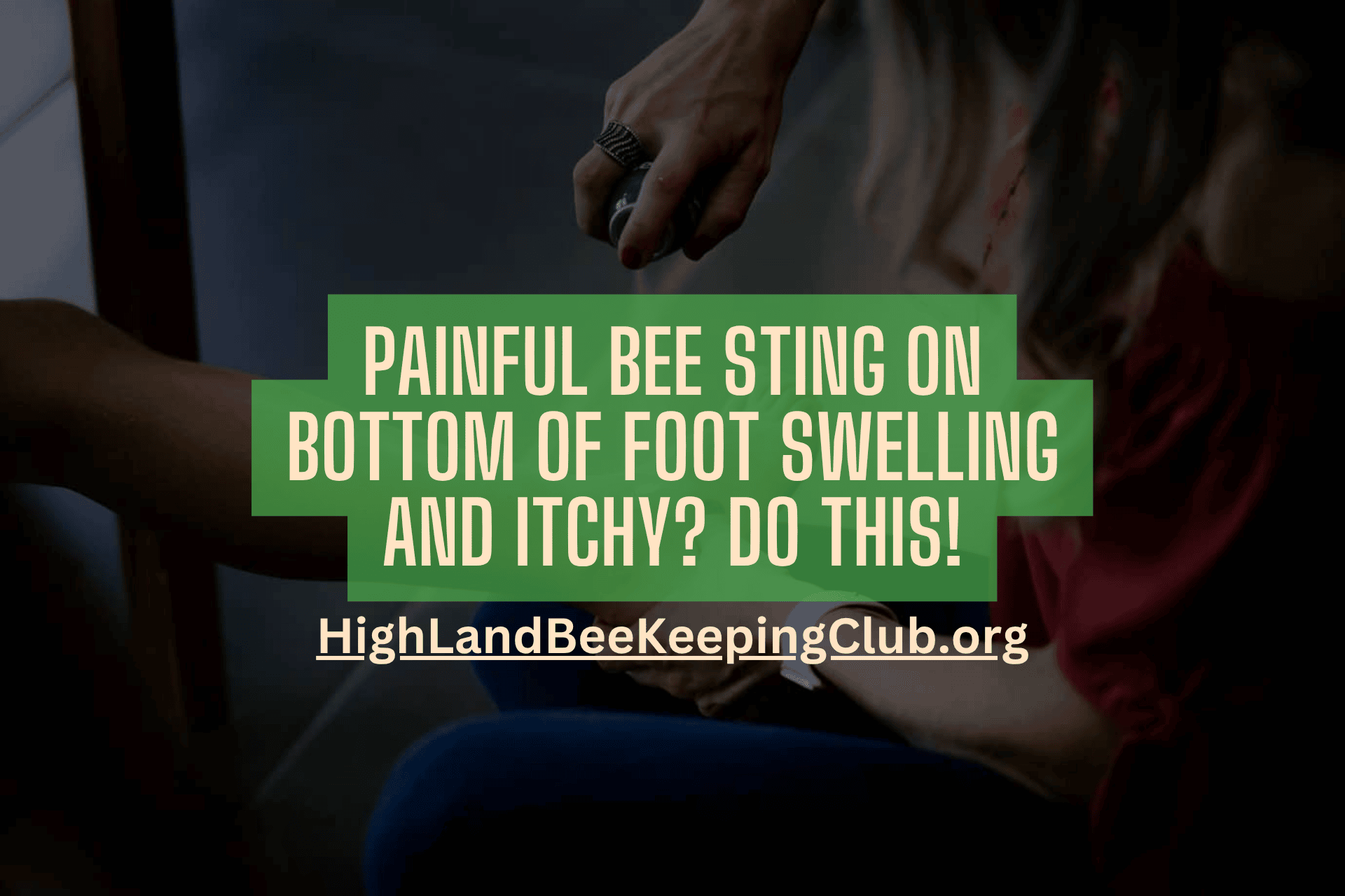 Painful Bee Sting On Bottom Of Foot Swelling And Itchy? Do This!